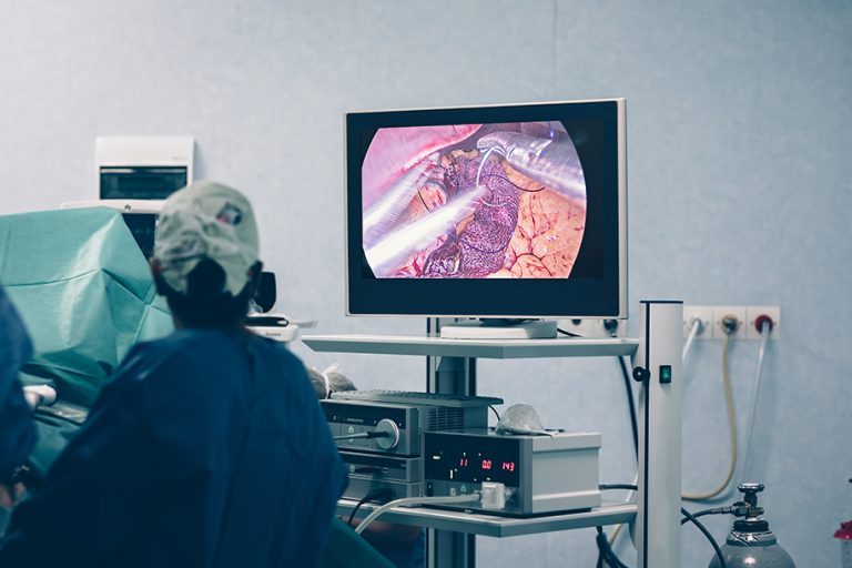 All You Need to Know About Drinking Alcohol After Gastric Sleeve ...